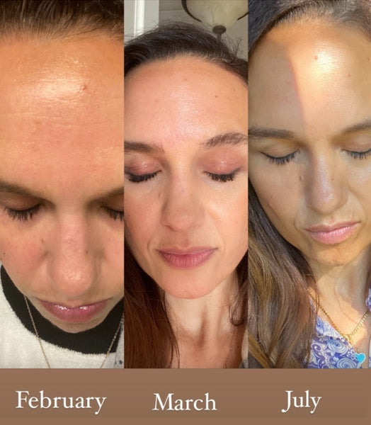 WHY I LOVE FURLESSE | Furlesse